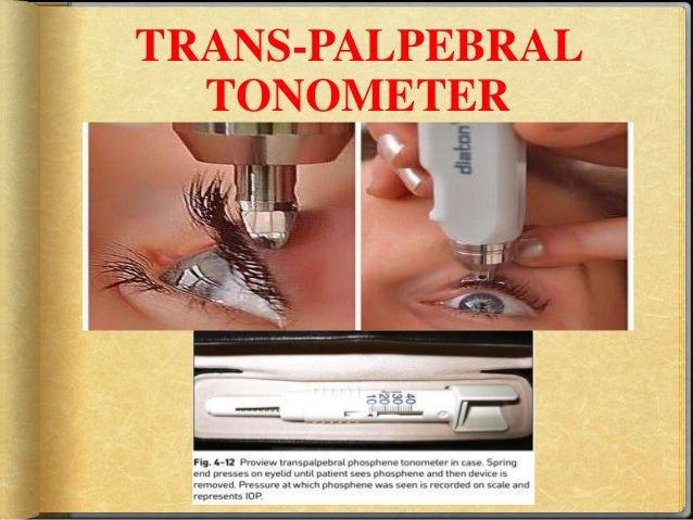 Different types of Tonometry