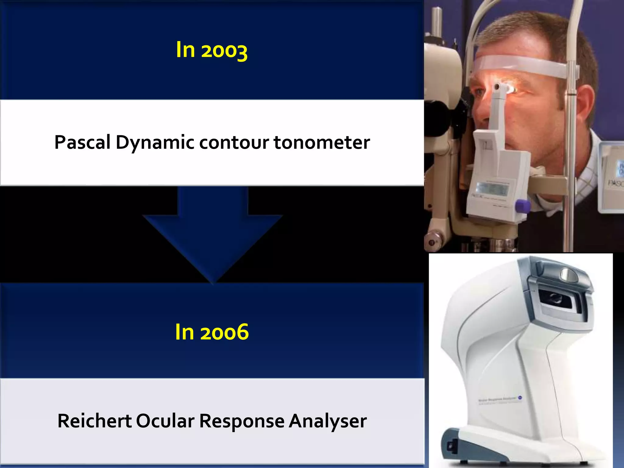 TONOMETRY | PPTX | Eye and Vision Conditions | Diseases and Conditions