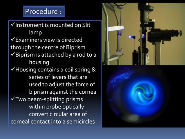 TONOMETRY | PPTX | Eye and Vision Conditions | Diseases and Conditions