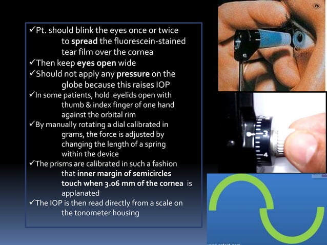 TONOMETRY | PPTX | Eye and Vision Conditions | Diseases and Conditions