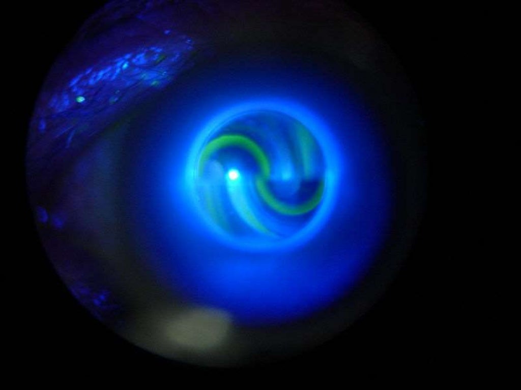 Tonometry and tonography