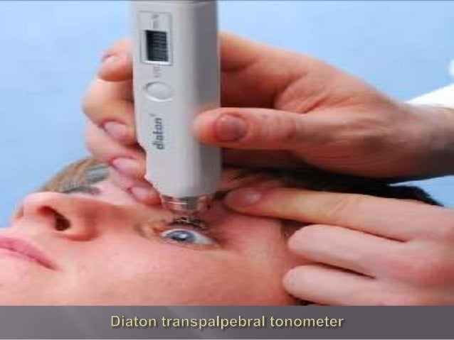 Tonometry and tonography