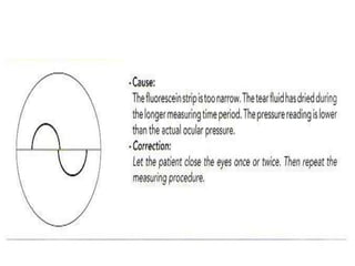 Tonometry and tonography | PPT