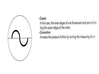 Tonometry and tonography | PPT