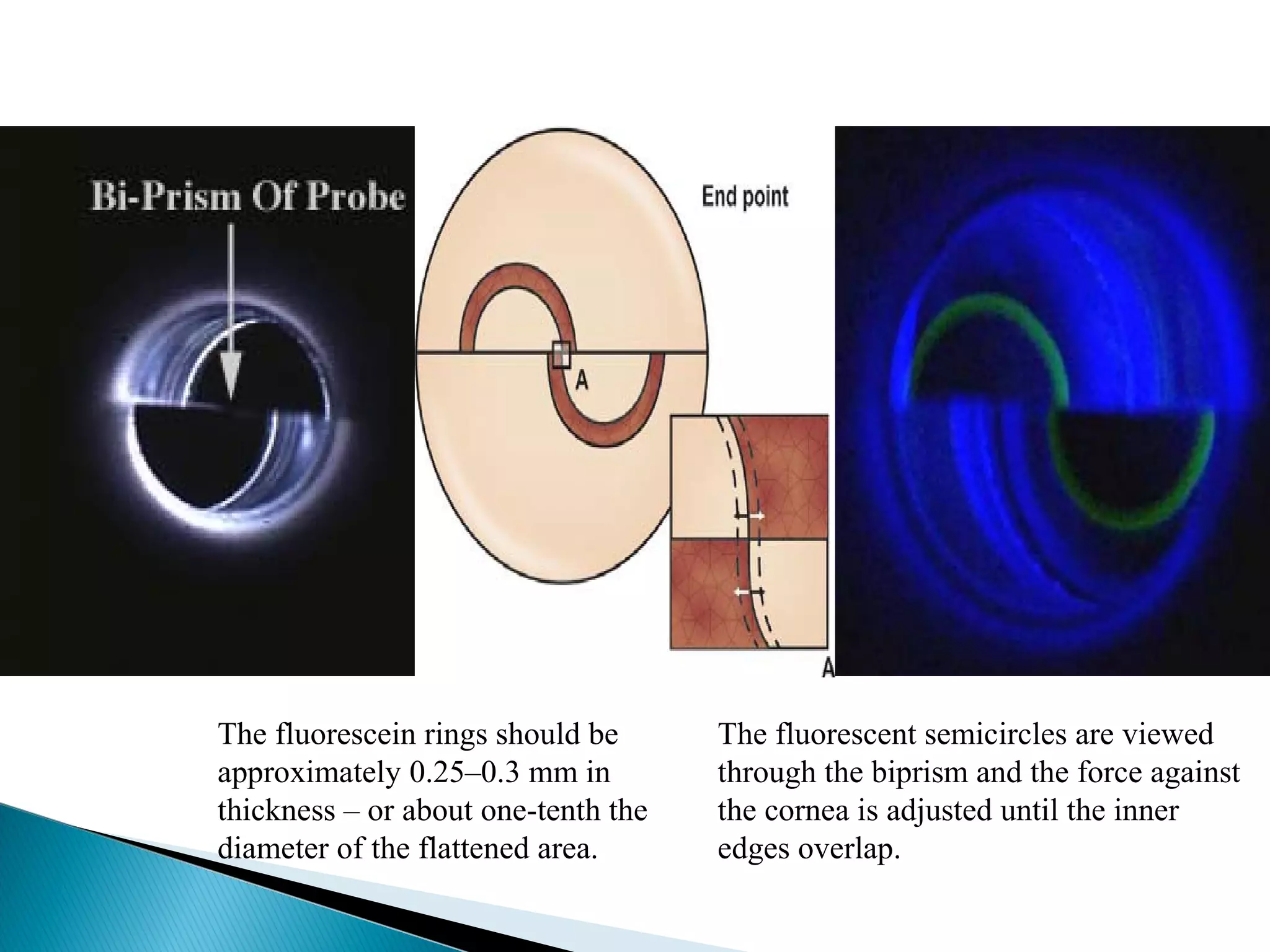 Tonometry by dr. mamta meena | PPT