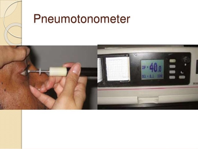 Tonometry & its recent advances