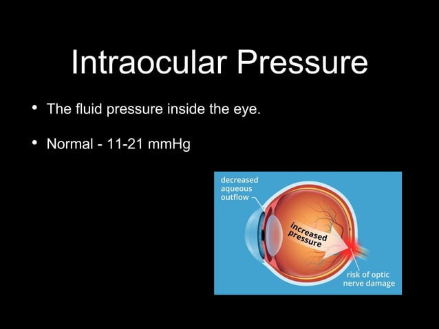 INTRAOCULAR PRESSURE &TONOMETRY Dr. ZAW MIN HTET (OPHTHALMOLOGIST) | PPT