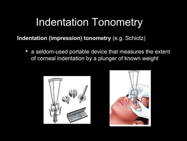 INTRAOCULAR PRESSURE &TONOMETRY Dr. ZAW MIN HTET (OPHTHALMOLOGIST) | PPT