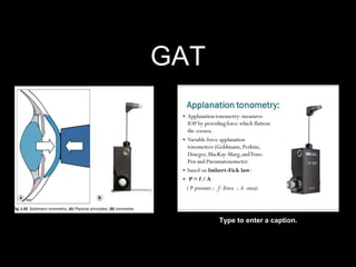 INTRAOCULAR PRESSURE &TONOMETRY Dr. ZAW MIN HTET (OPHTHALMOLOGIST) | PPT