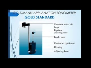 INTRAOCULAR PRESSURE &TONOMETRY Dr. ZAW MIN HTET (OPHTHALMOLOGIST) | PPT