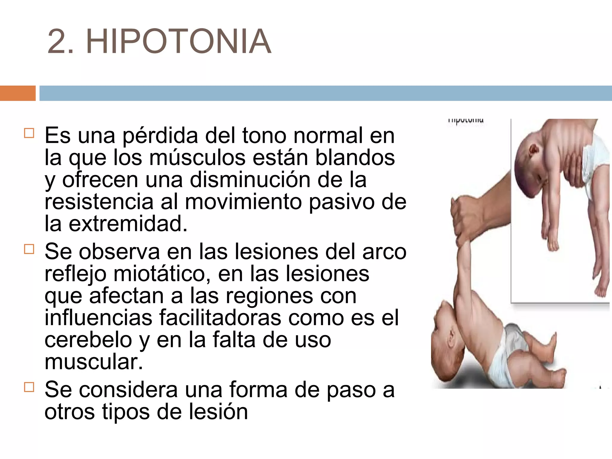 Tono muscular | PPT