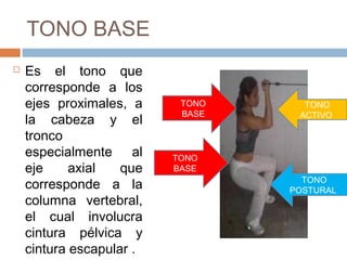 Tono muscular | PPT