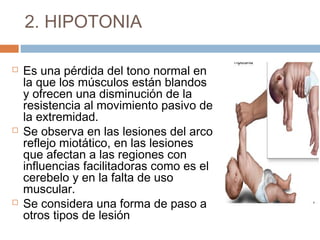 Tono muscular | PPT