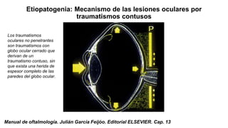 TRAUMA OCULAR CERRADO. | PPTX