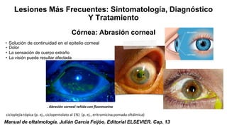 TRAUMA OCULAR CERRADO. | PPTX