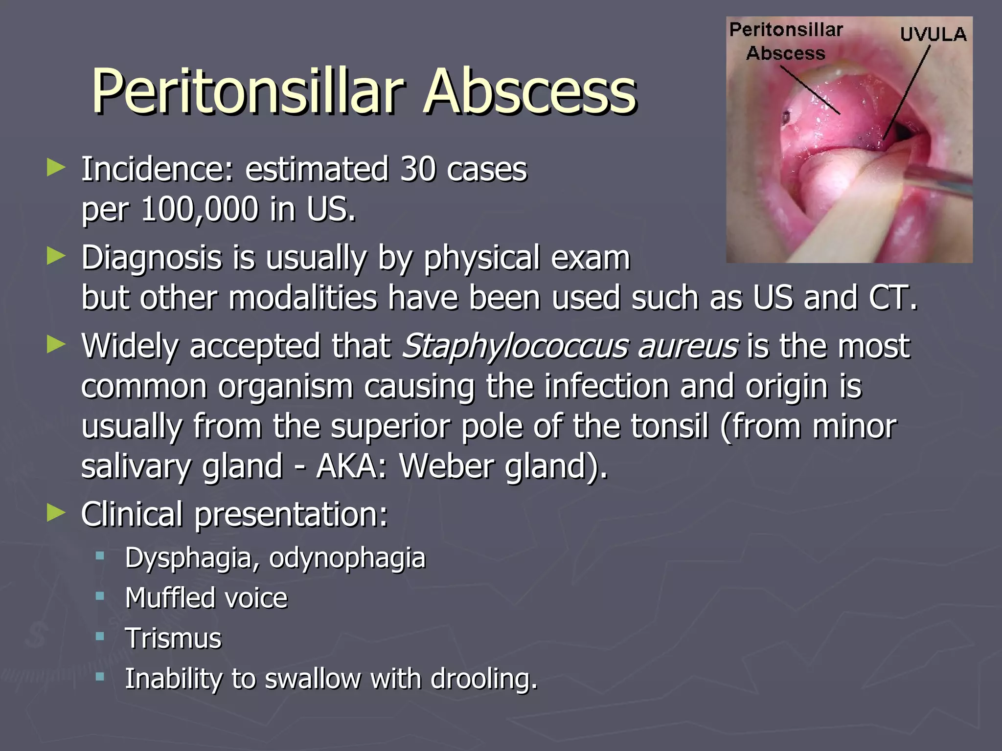 Special situations in tonsil and Adenoid disorder Special situations in ...