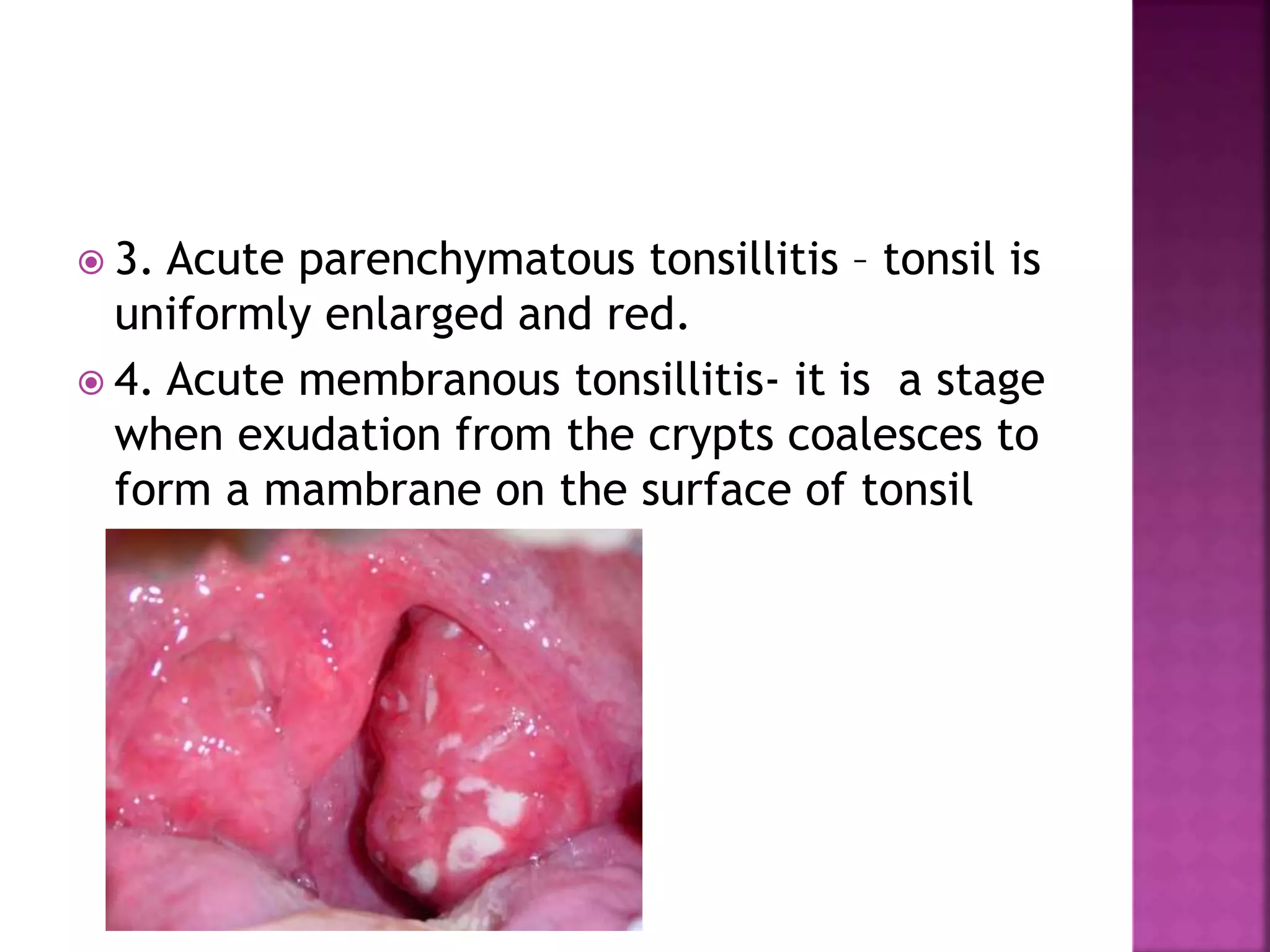 Tonsil anatomy and acute tonsil | PPTX