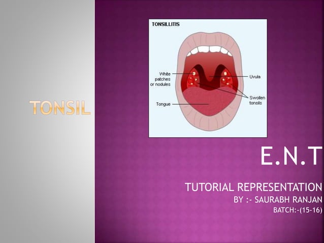 Tonsil anatomy and acute tonsil | PPTX
