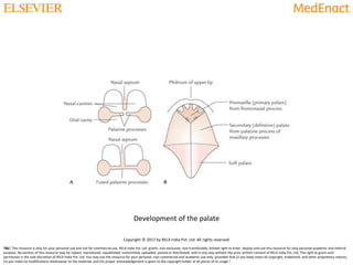tonsil and palate ppt copy.pptx