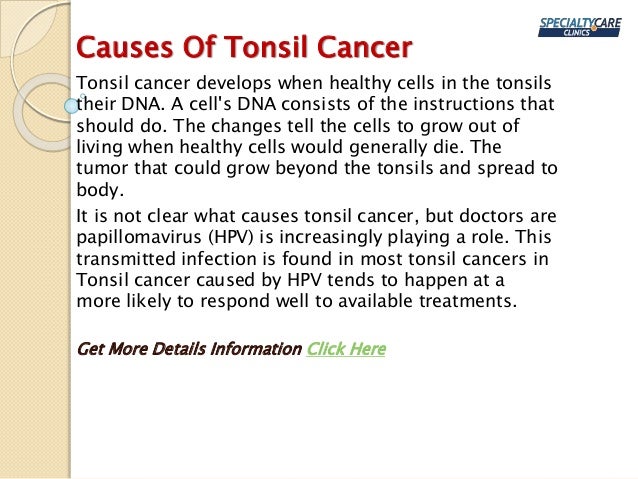 Tonsil cancer symptoms, causes, and treatment | PPT
