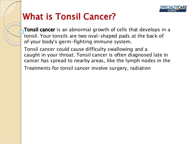 Tonsil cancer symptoms, causes, and treatment