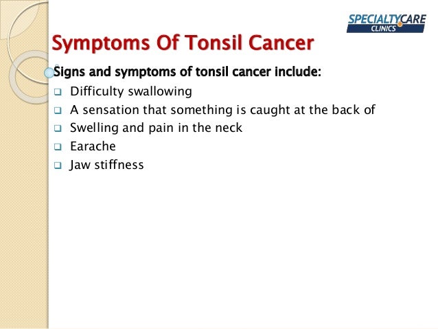 Tonsil cancer symptoms, causes, and treatment