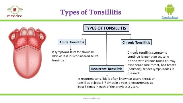 Tonsillitis types,Causes,Symptoms,Diagnosis,Prevention and treatment