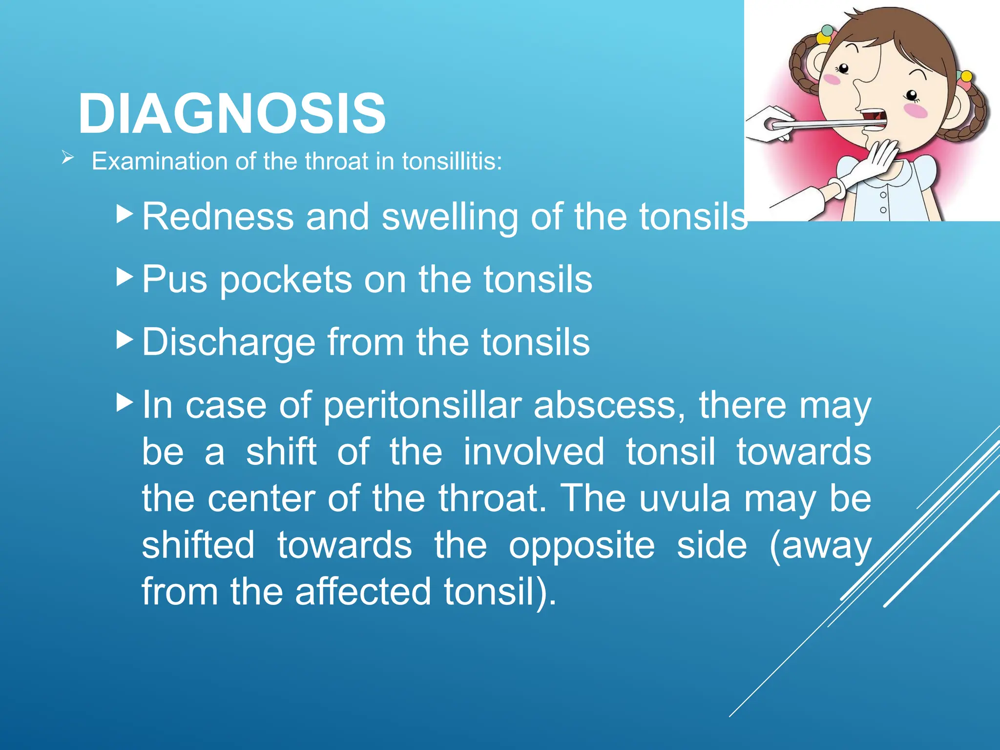 tonsilillitis and its nursing management .pptx