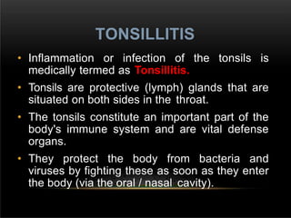 Tonsilities | PPTX