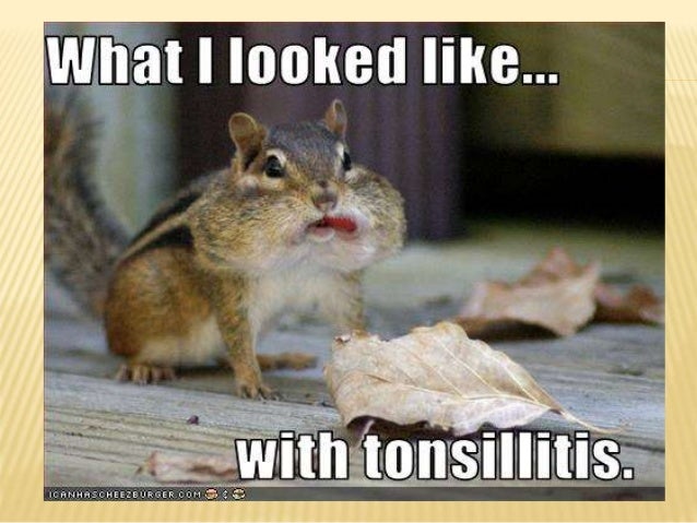Tonsilitis