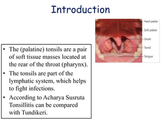 effect of trikatukadi pratisarana in tundikeri(tonsillitis)-A case ...