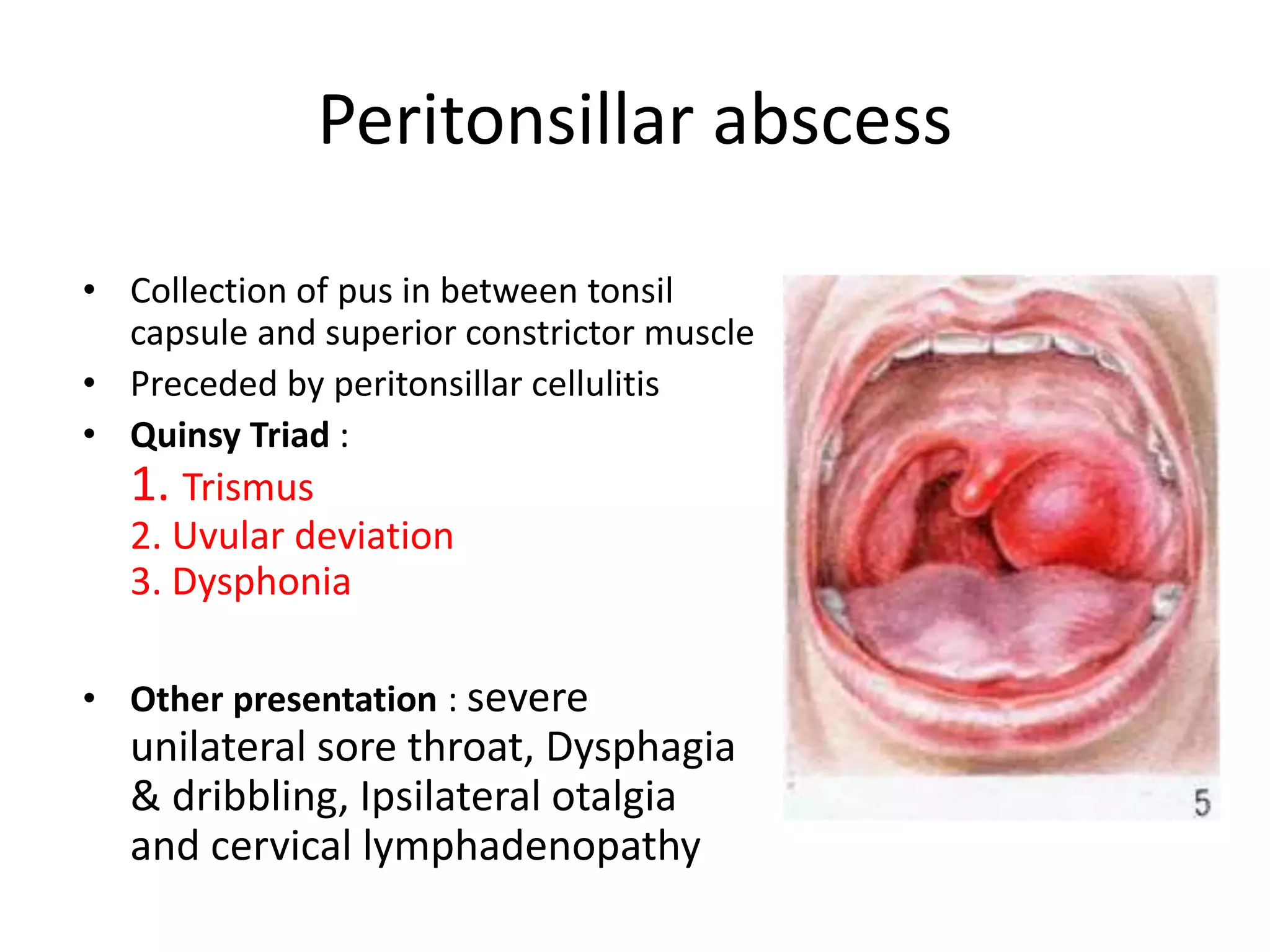 approch to patient with Sore throat | PPTX