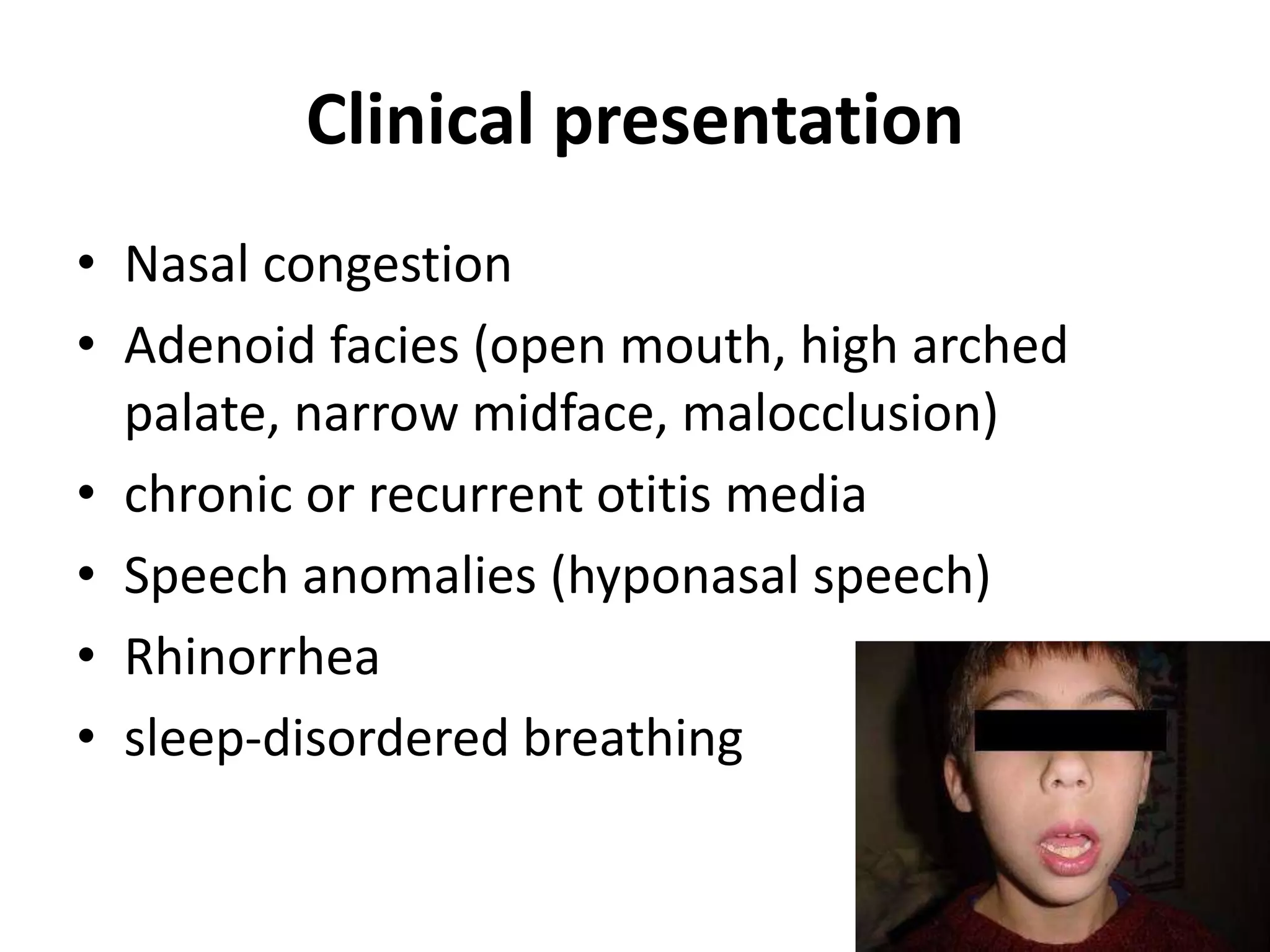 approch to patient with Sore throat | PPTX