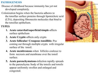 Tonsilitis: Anatomy, Physiology, Clinical Importance | PPT