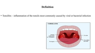 tonsilitis.pptx ENT EAR NOSE DISES MOUTHES | PPTX