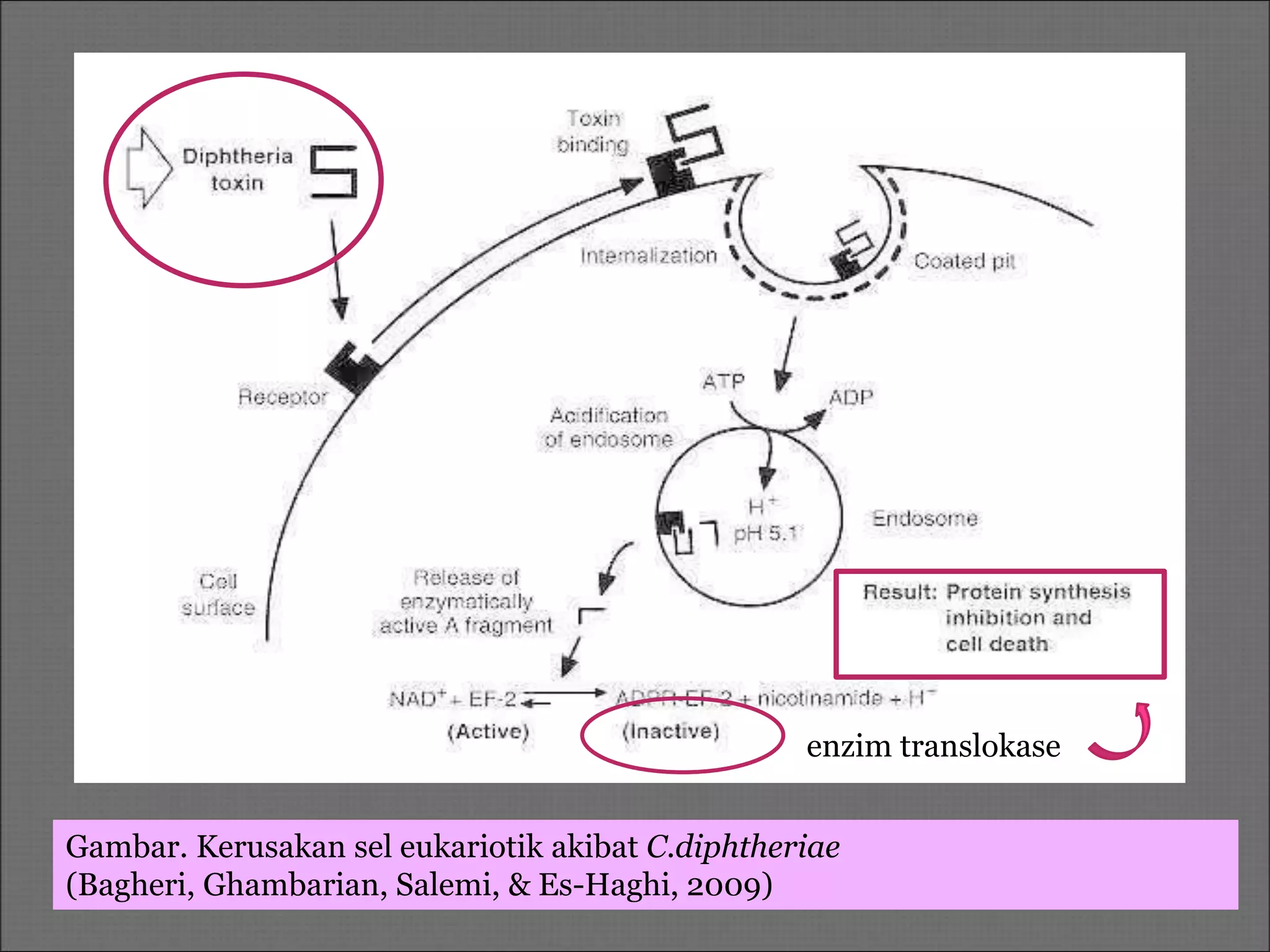 Tonsilitis Difteri_Vivi.pptx