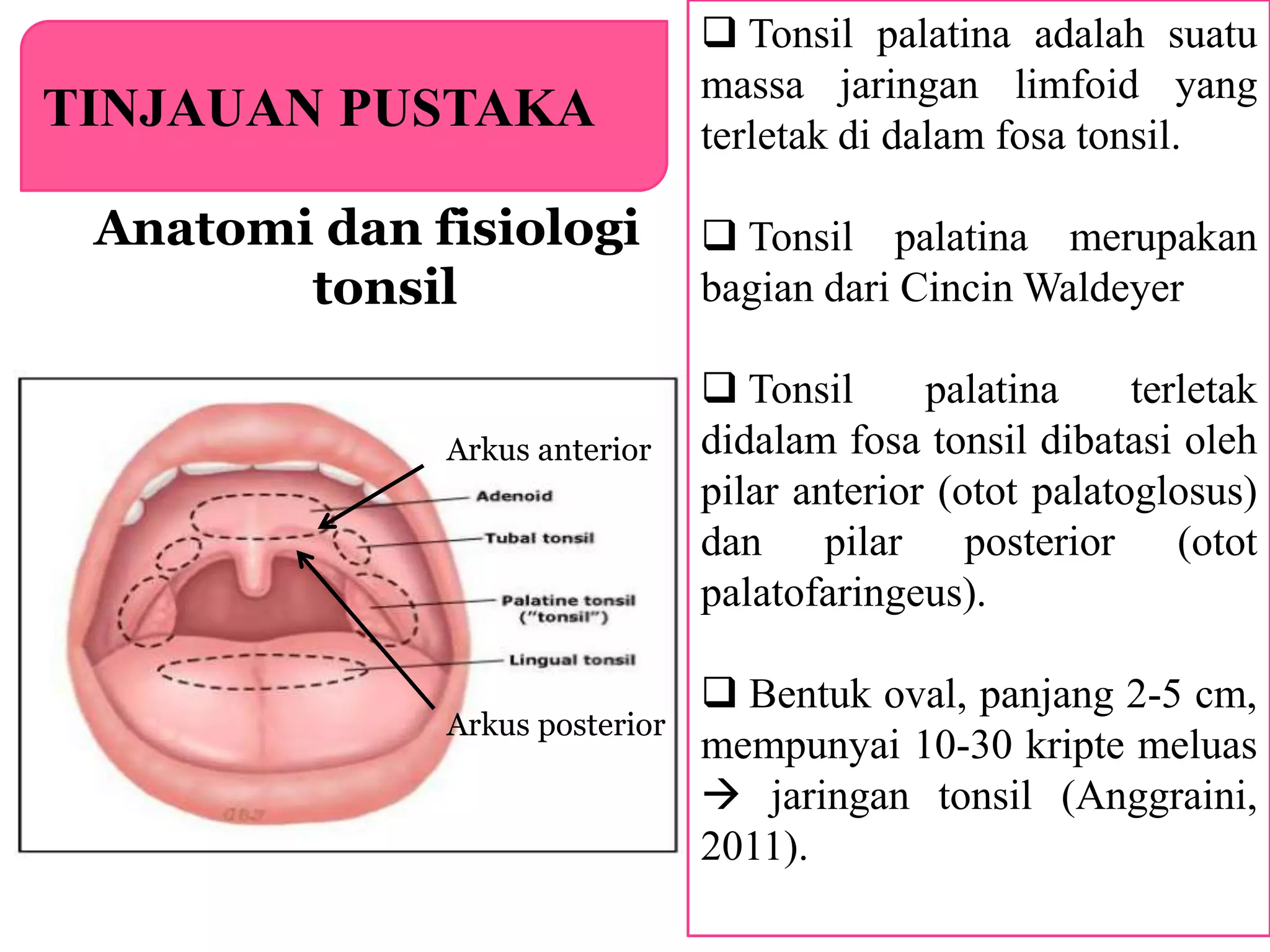 Tonsilitis Difteri_Vivi.pptx