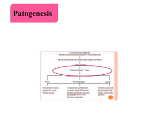 Tonsilitis Difteri_Vivi.pptx