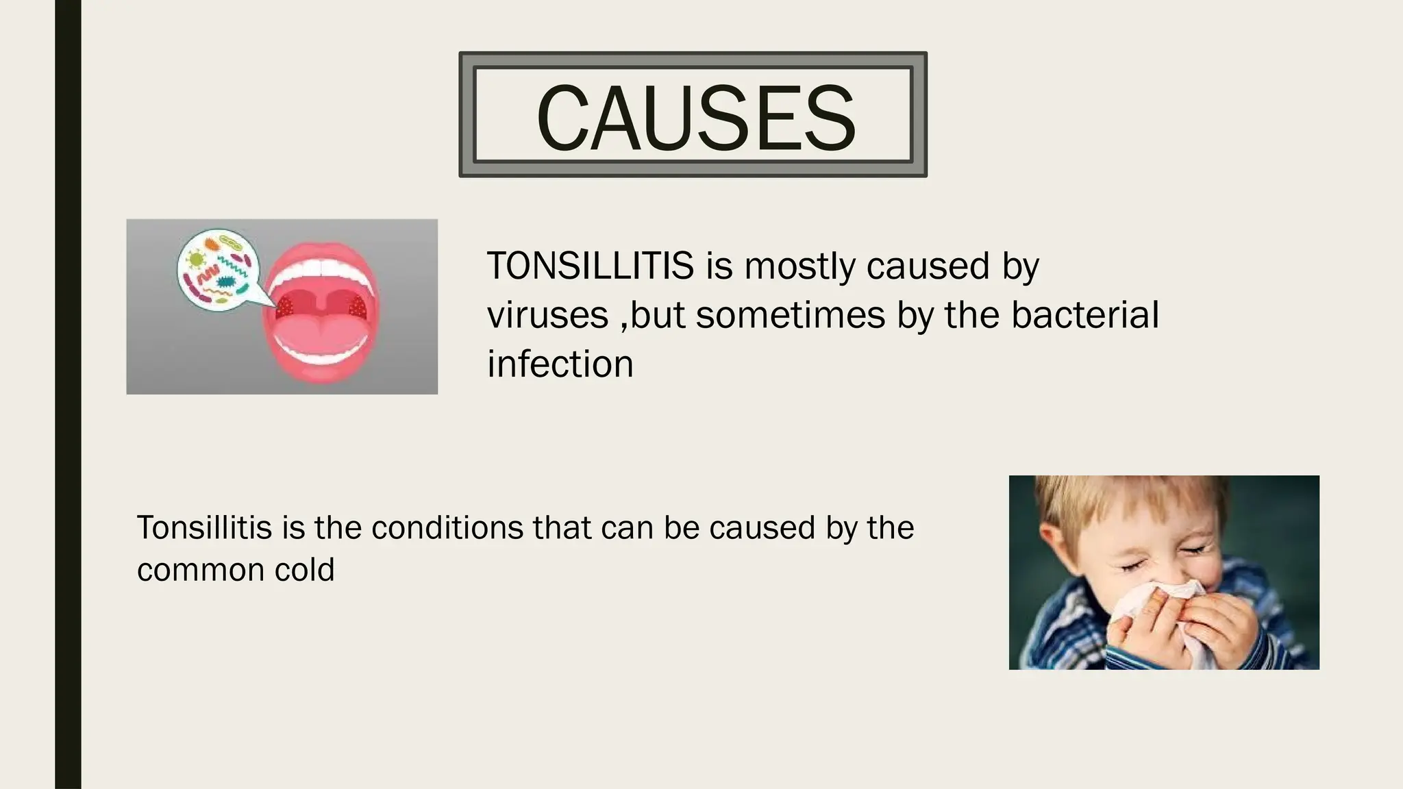 TONSILITIS Definition , types , causes , pathophysiology , riskfactors ...