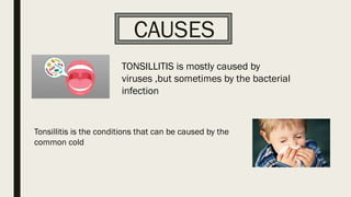 TONSILITIS Definition , types , causes , pathophysiology , riskfactors ...