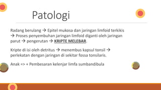 Tonsilitis Kronik.pptx