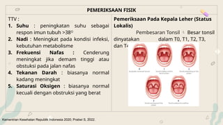 TONSILITIS KRONIK EKSASERBASI LAPORAN KASUS | PPTX