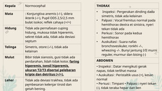 TONSILITIS KRONIK EKSASERBASI LAPORAN KASUS | PPTX