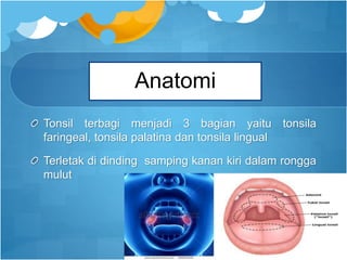 Tonsilitis kronis | PPTX