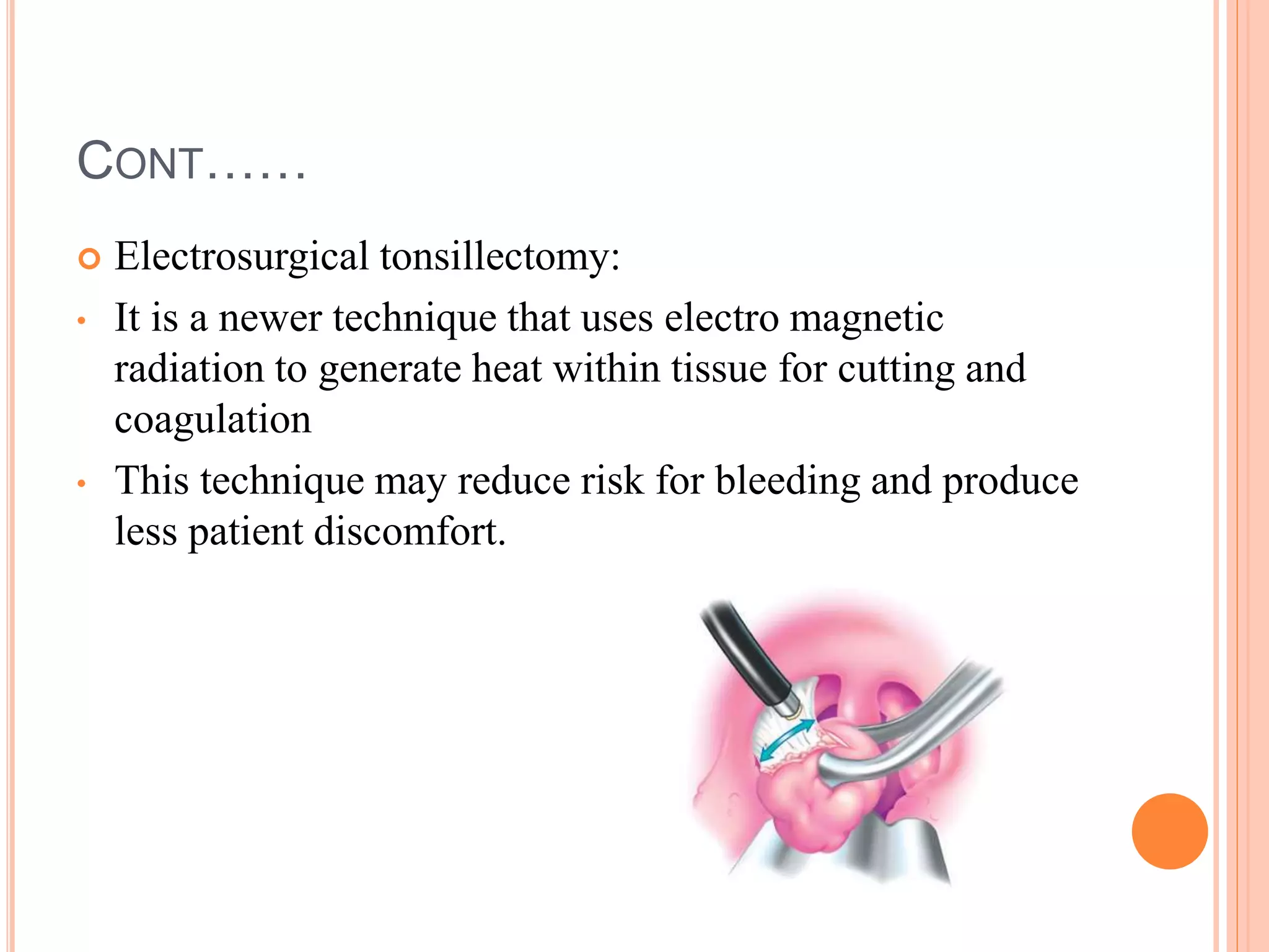 Tonsilitis ppt 1 | PPTX