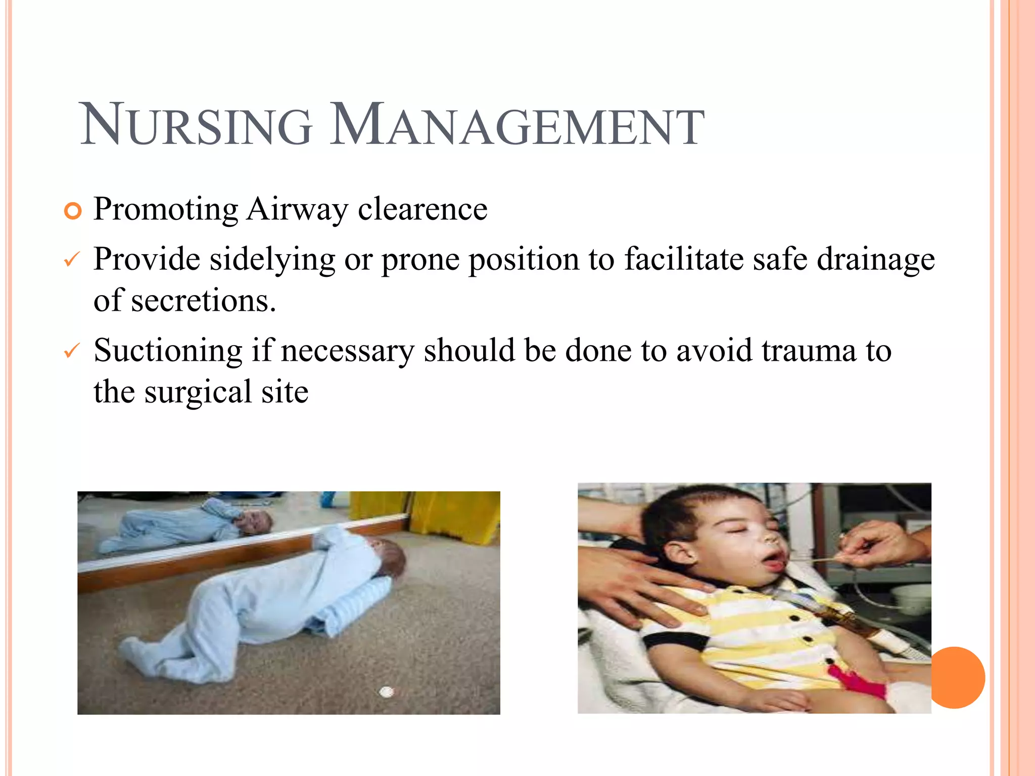 Tonsilitis ppt 1 | PPTX