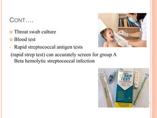 Tonsilitis ppt 1 | PPTX