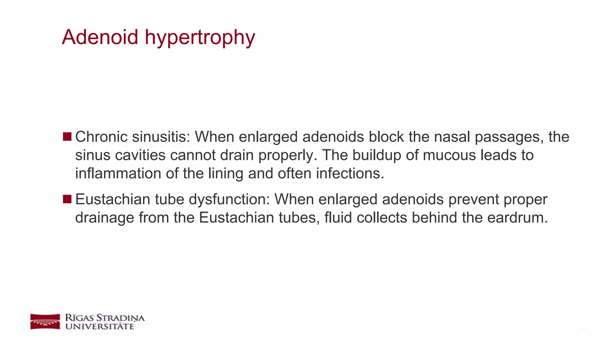 EBV connection to adenotonsillar hypetrophy | PPTX