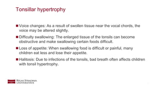 EBV connection to adenotonsillar hypetrophy | PPT
