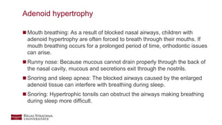 EBV connection to adenotonsillar hypetrophy | PPT